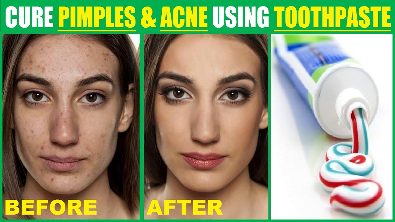 How to make your Skin White - Skin Whitening using Toothpaste - Fitness Aim