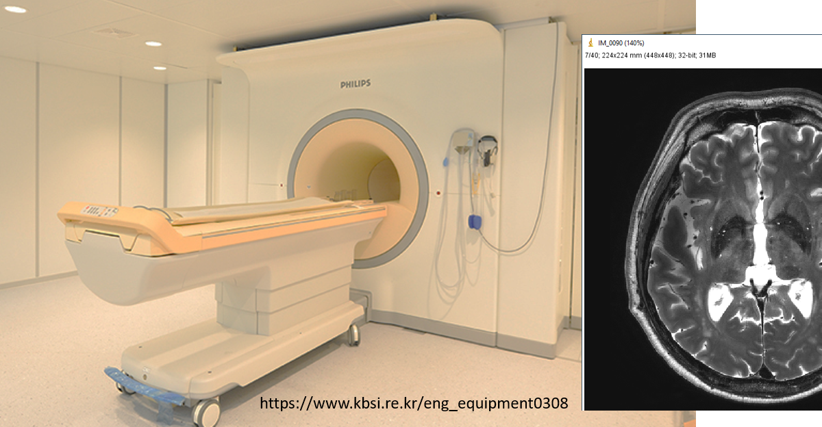 Seungkyun's Magnetic Resonance Life Blog: 7T MRI at KBSI
