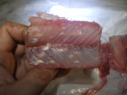 İnsan orqanizminin parazitlərdən təmizlənməsi. Trigelm. "Sibirskoe ...