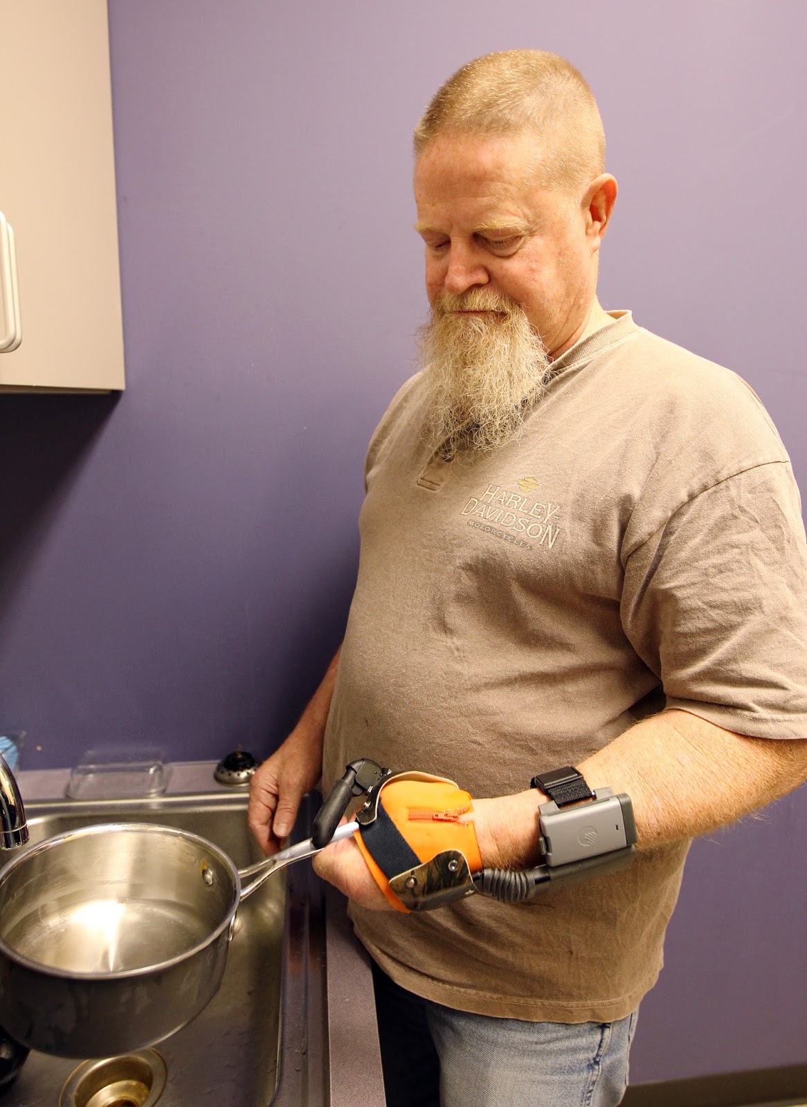 Mark Kodiak Ukena: Adam Pringle and his Bionic Thumb at Dynamic Hand ...