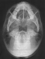 RADIOLOGIA: POSICIONAMENTO DA FACE