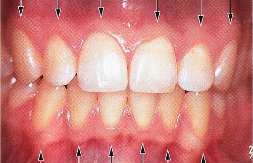 Dentistry lectures for MFDS/MJDF/NBDE/ORE: Note on Anatomy and ...