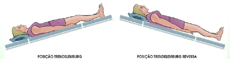 Enfermeiro em formação: Principais Posições para Exames e Procedimentos ...