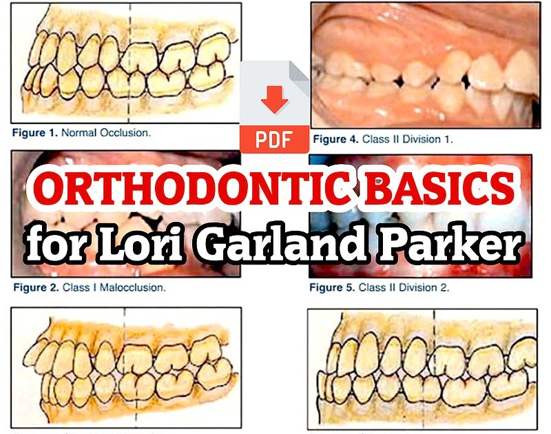 PDF: ORTHODONTIC BASICS for Lori Garland Parker - Ovi Dental