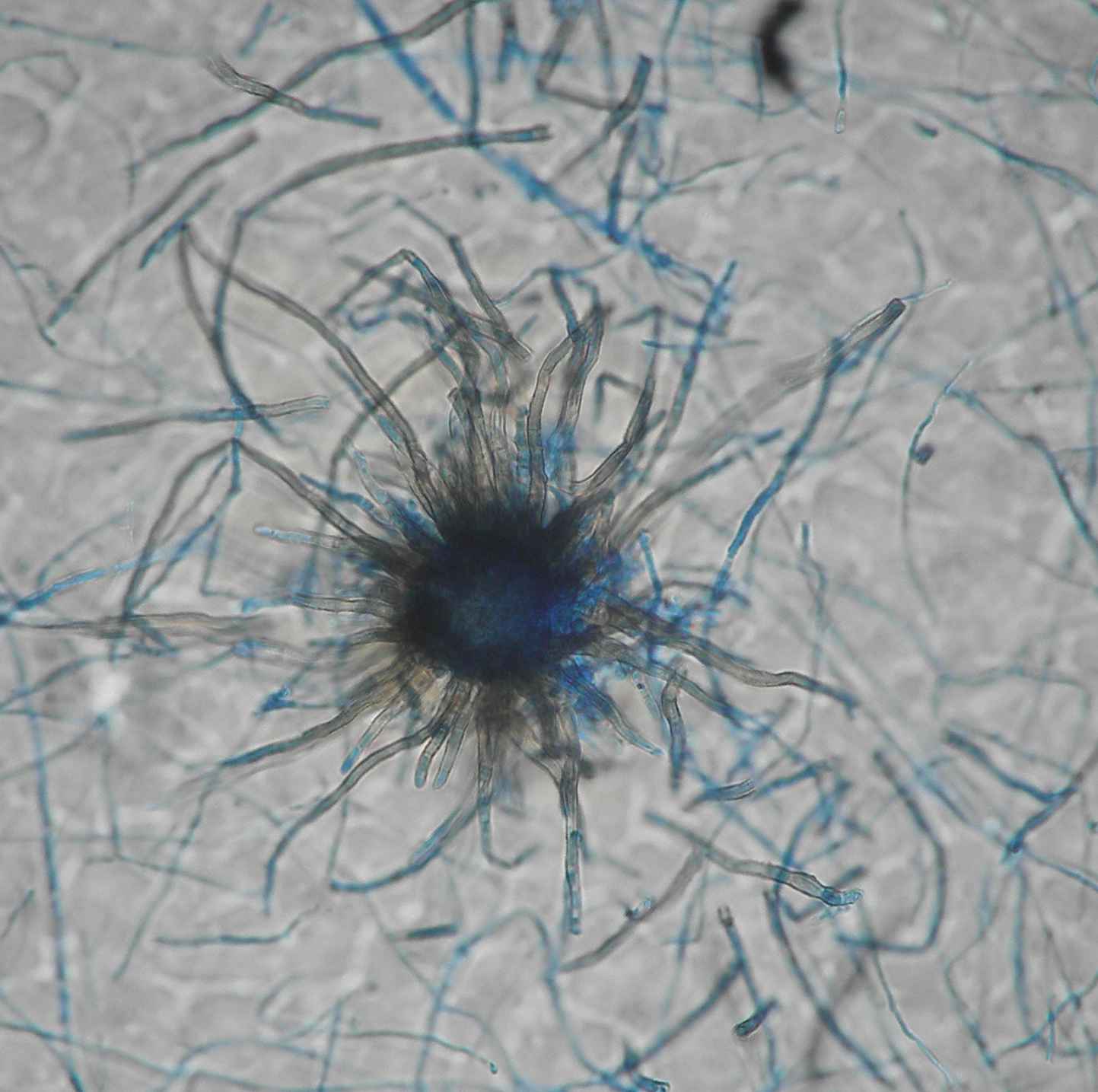 ATLAS MICOLOGIA: CHAETOMIUM SPECIES