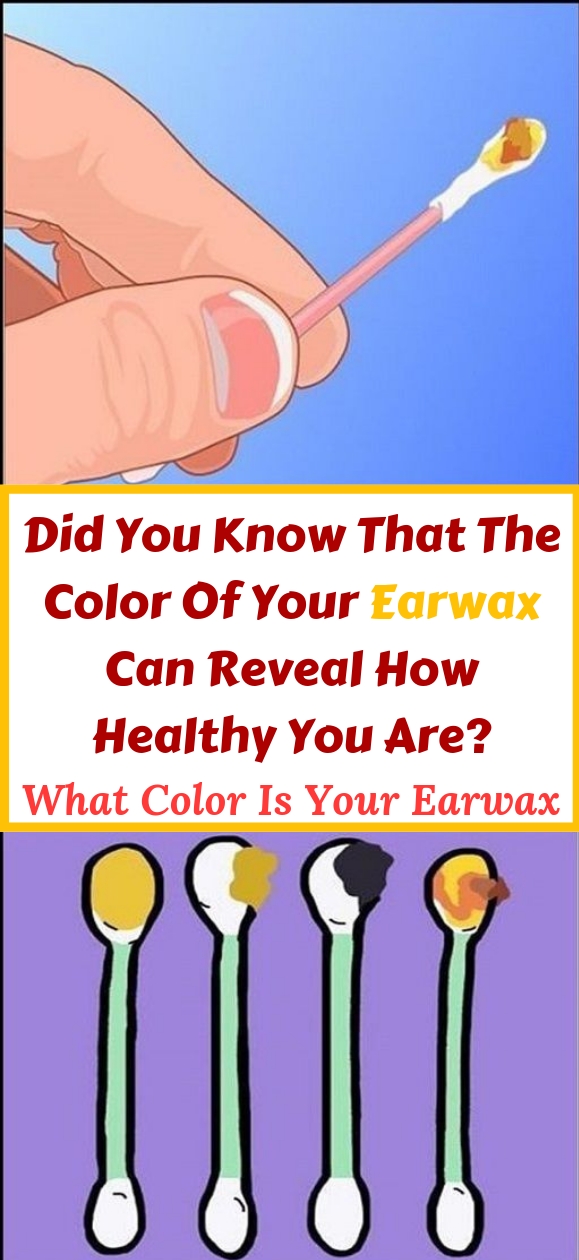 Did You Know That The Color Of Your Earwax Can Reveal How Healthy You ...