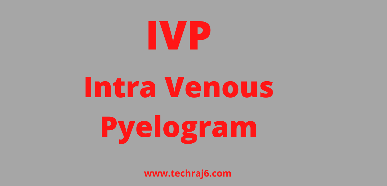 IVP full form, What is the full form of IVP