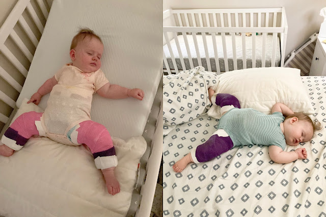 How to Survive (and Thrive!) with a Hip Spica Cast - The Baker Upstairs