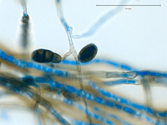 Fun With Microbiology (What's Buggin' You?): Pithomyces species