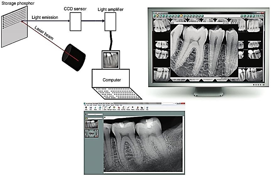 Digital radiography l Oral radiology MCQs - WikiDentia