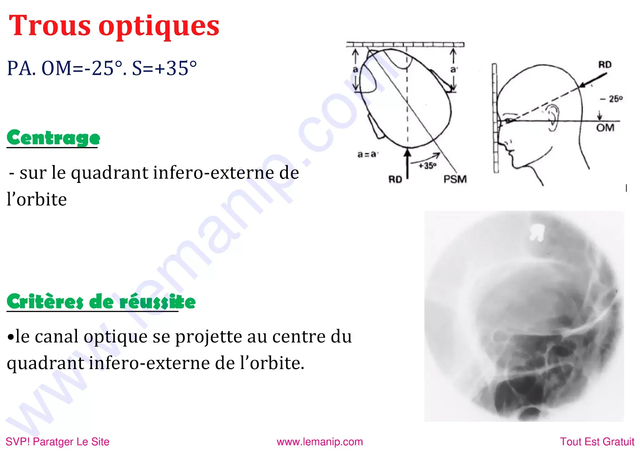 Incidences Radiologique Et Constantes Et Critères De Réussite PDF