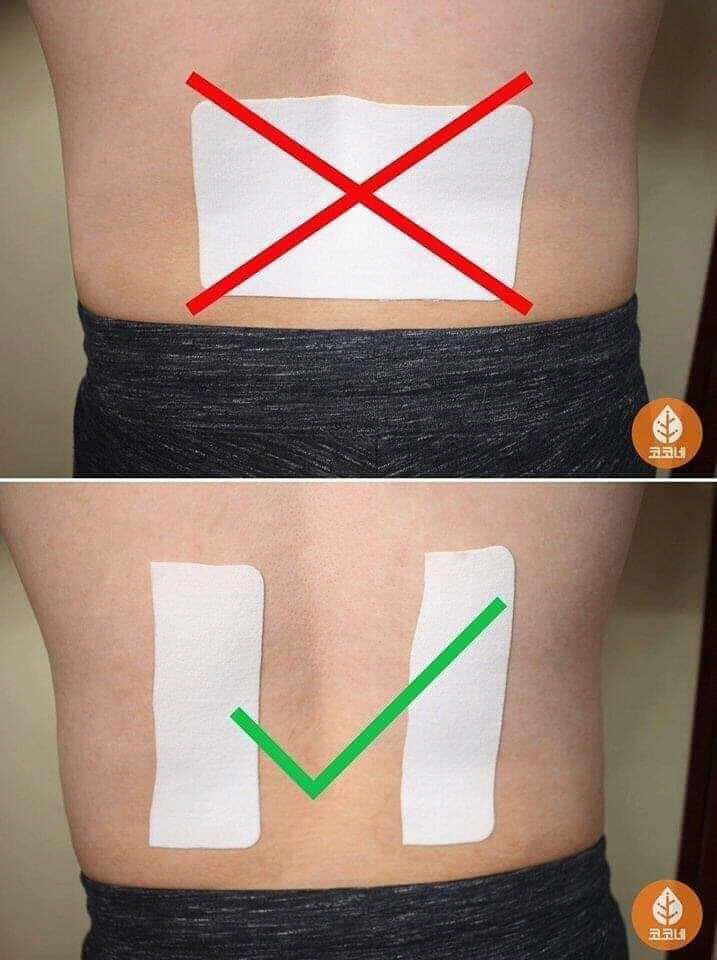 Cara Menggunakan Koyo yang Benar