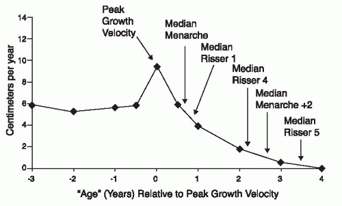 What is Bone Age? Why does it matter for treatment of scoliosis ...