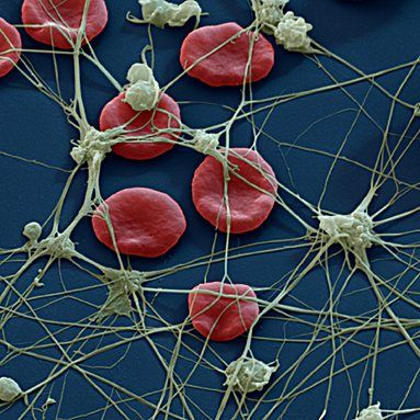 Medical and Health Science: The damaged blood vessel wall is covered by ...