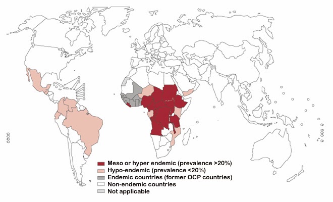 Genius Intraocular Technology: Oncocercosis o "ceguera de los rios"