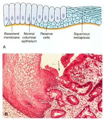 Makalah Patofisiologi Atrofi Sel