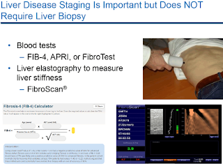 FibroScan® Understanding The Results
