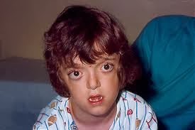 Ridiculously confortable : PERIPHERAL SIGNS