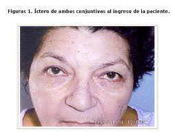 Dr- Abel Dorilus semiologia QX (UTESA): febrero 2012