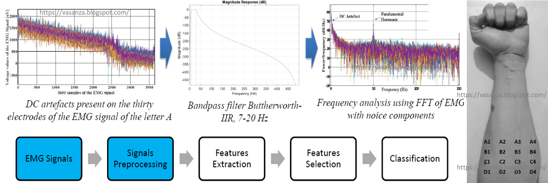 #EMG signal #Classification with #MachineLearning based on #FPGA