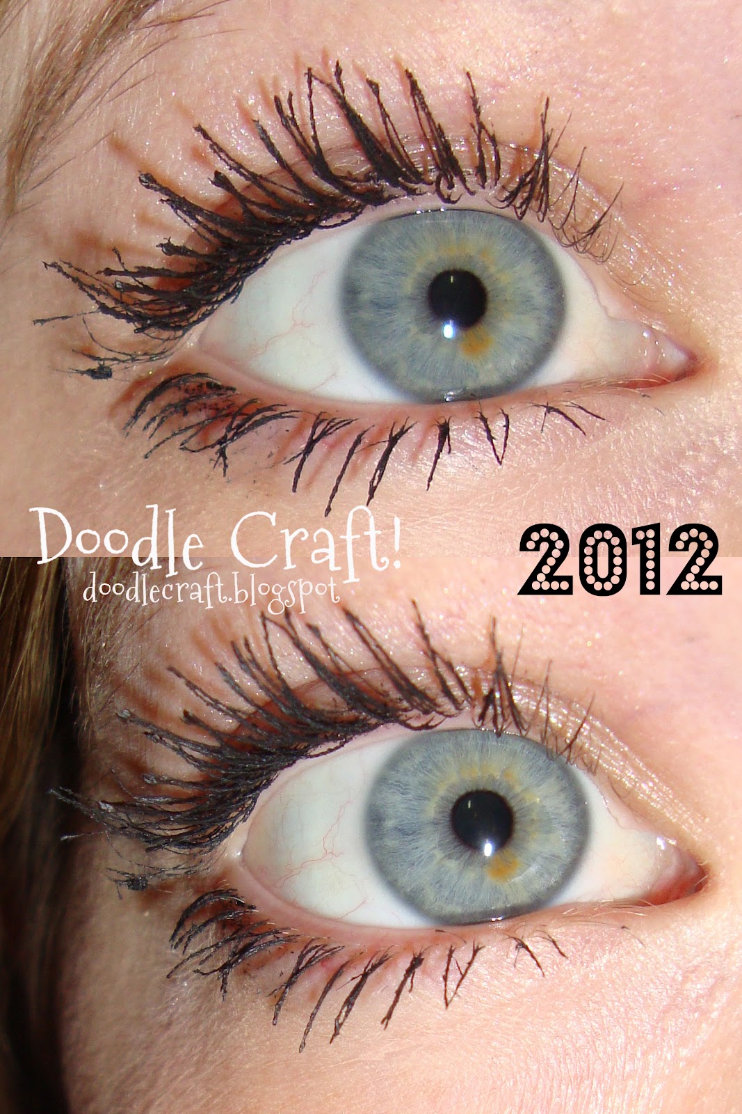 Eyelashes Kids Latisse eyelashes-kids-latisse