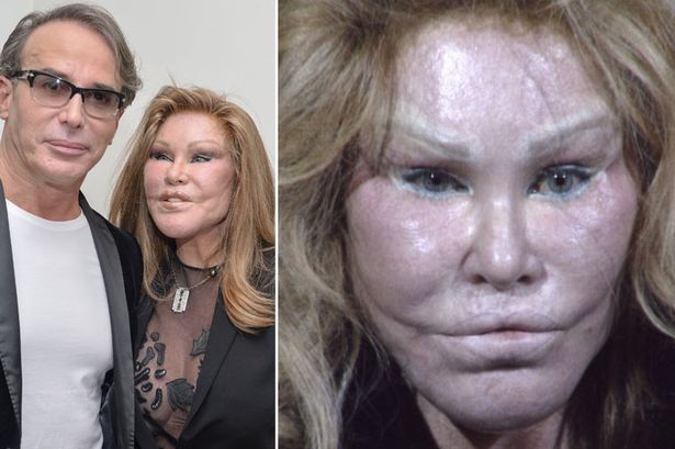 Catwoman Jocelyn Wildenstein reveals she's spent $6.5m on plastic ...