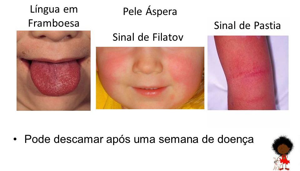 Play na Saúde: Doença de Dukes