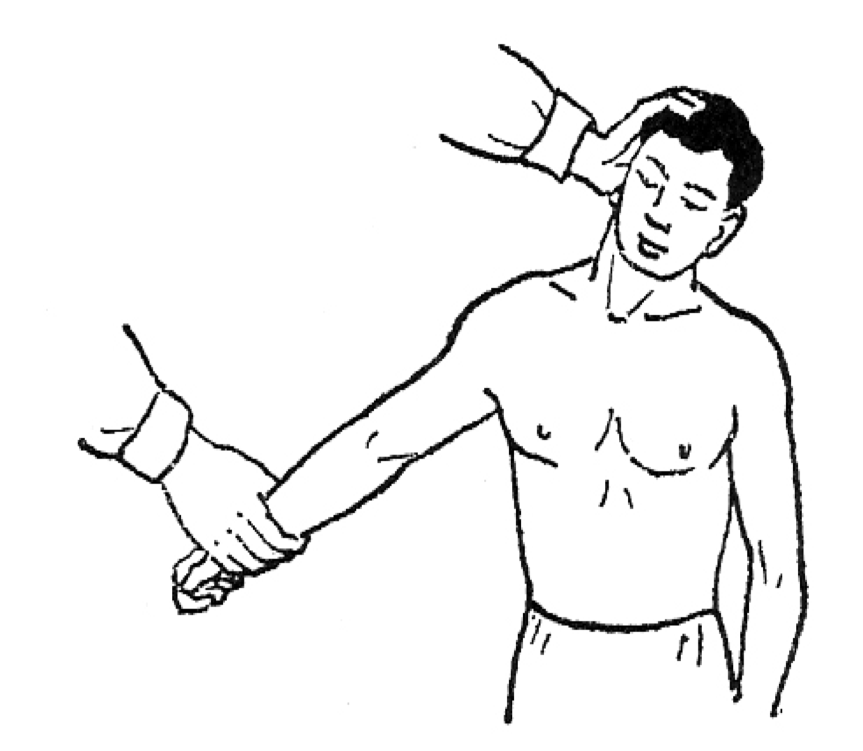 Neuro Habits: Cervical Spondylosis