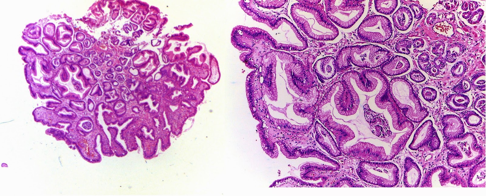 GASTROINTESTINAL AND LIVER HISTOLOGY PATHOLOGY ATLAS: STOMACH ...