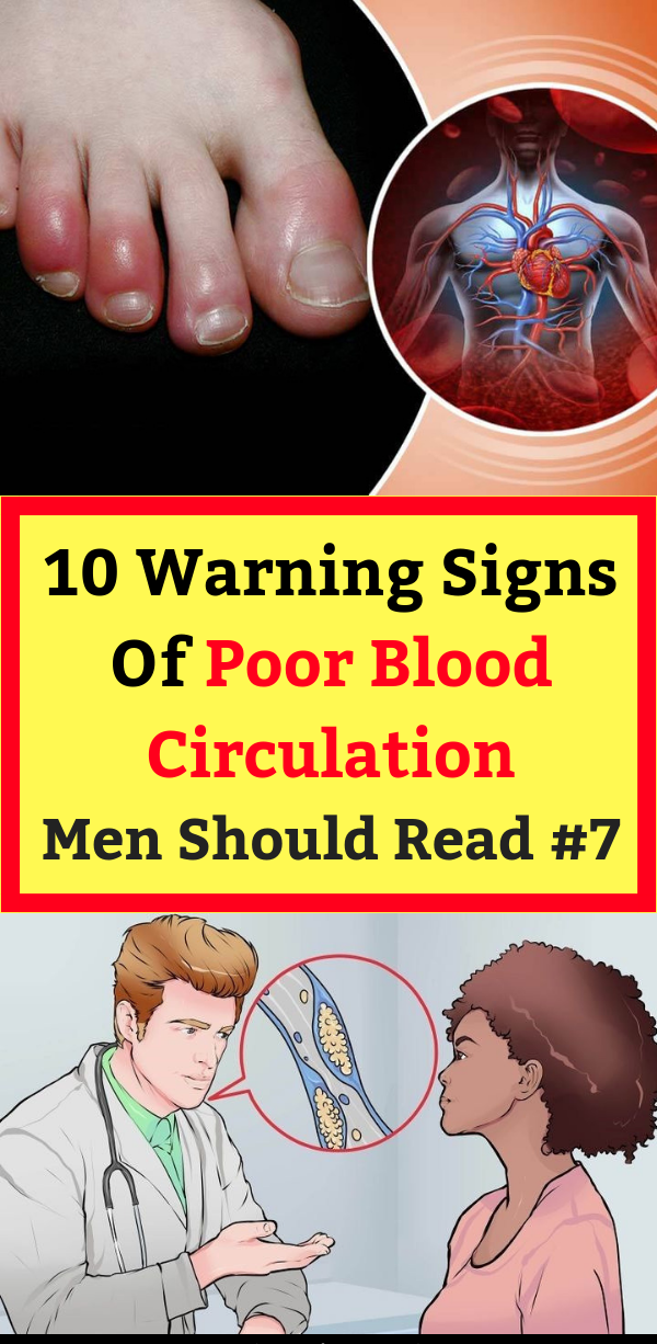 10 Warning Signs Of Poor Blood Circulation - Healthy Lifestyle