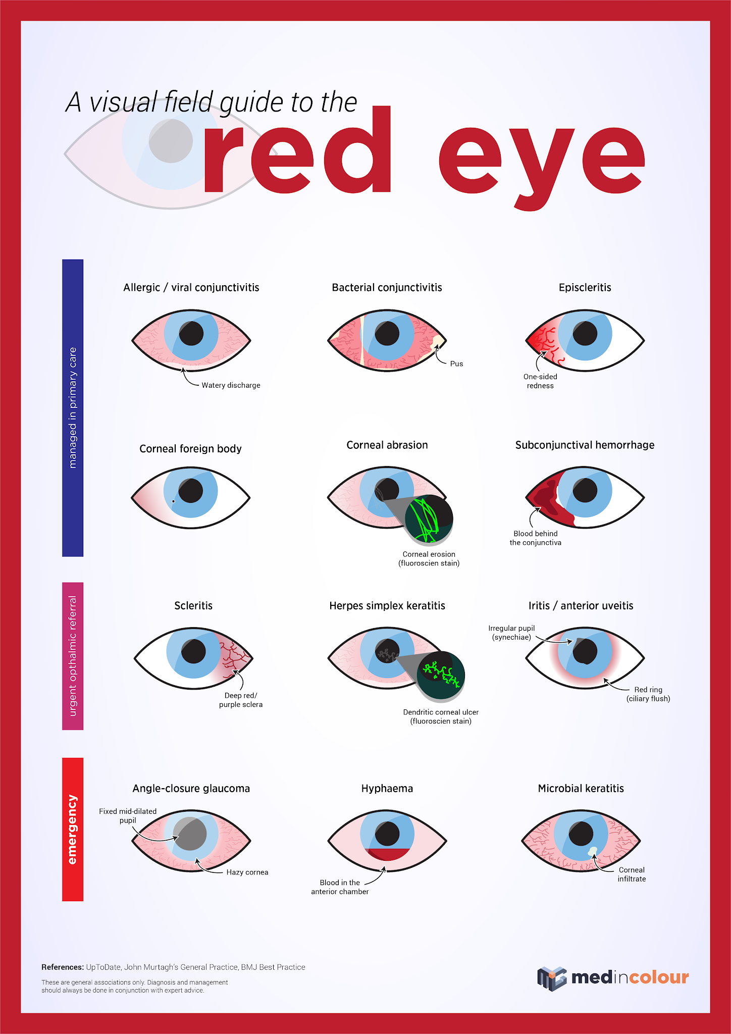 Types of Red Eye