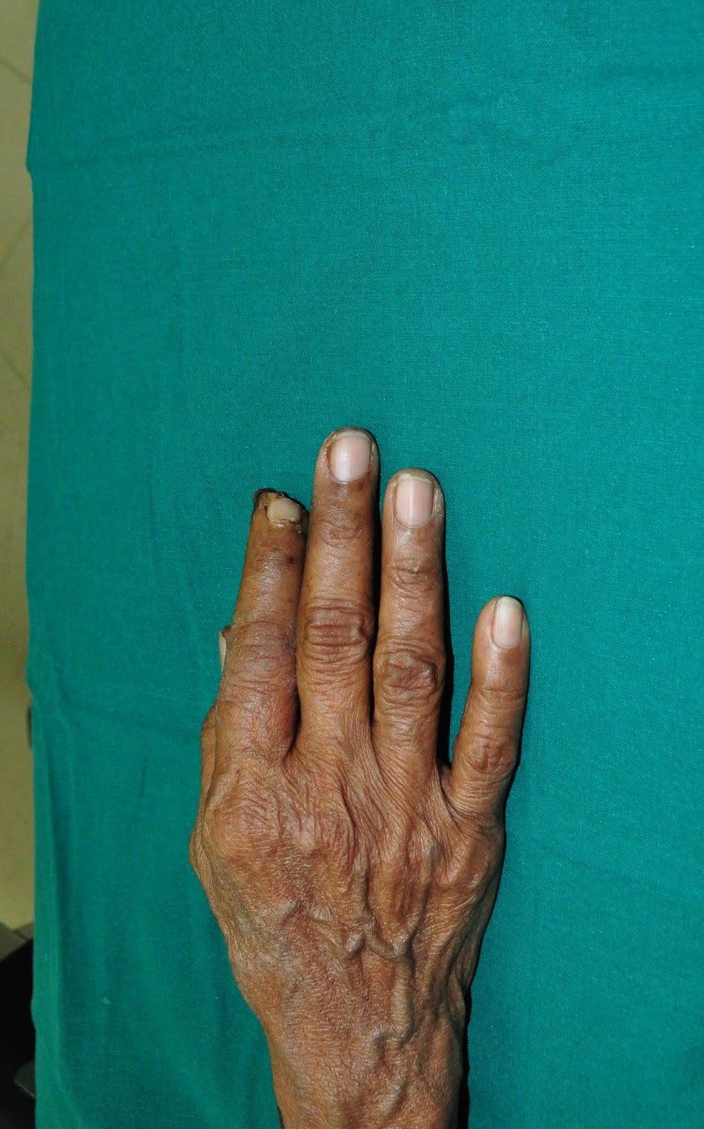 Cigarette Paper Skin