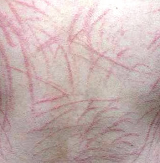 Green Grandma: Keep that shiitake away from me!