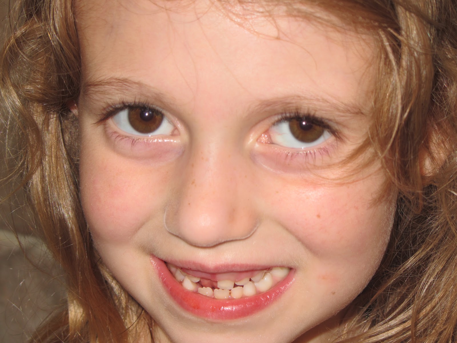 dksquared: Lost Tooth Girl