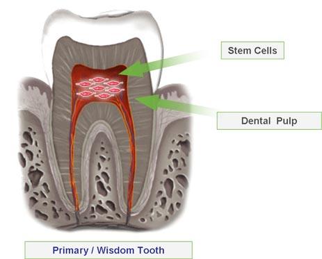 Dental pulp stem cells : Definition |Genetic Engineering Info