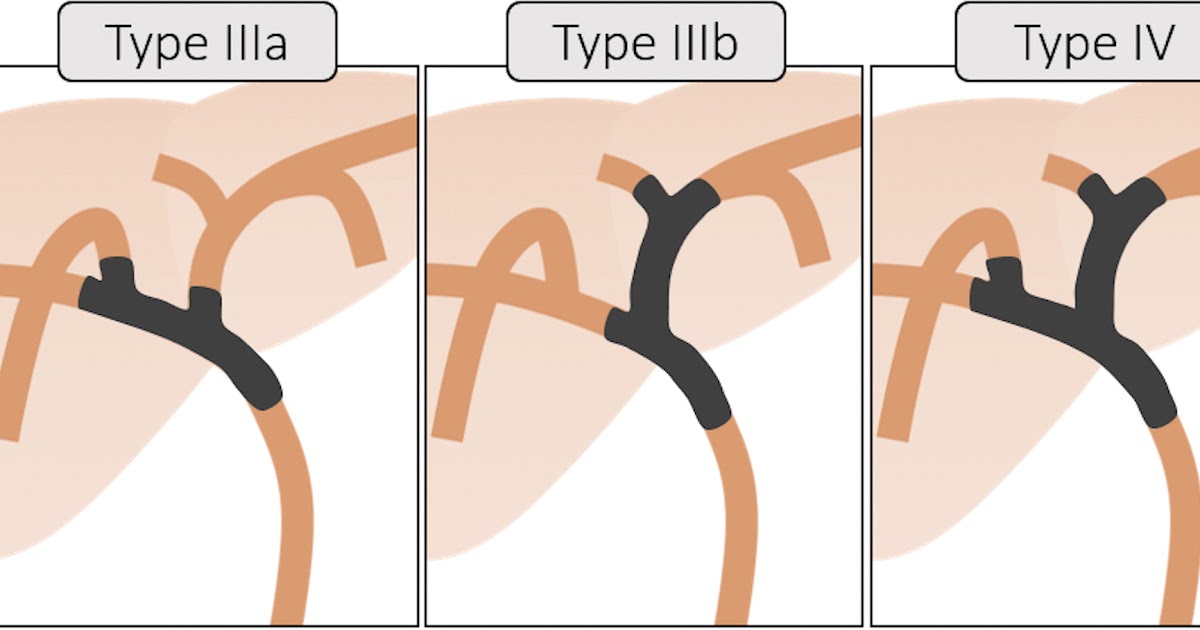 Radiographics reviews