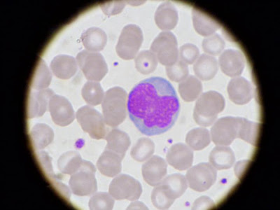 VETERINARY HEMATOLOGY DEXTERVET: monocytoid appearance variant ...