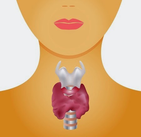 Pengertian Hipertiroid, Gejala, Penyebab dan Perawatan