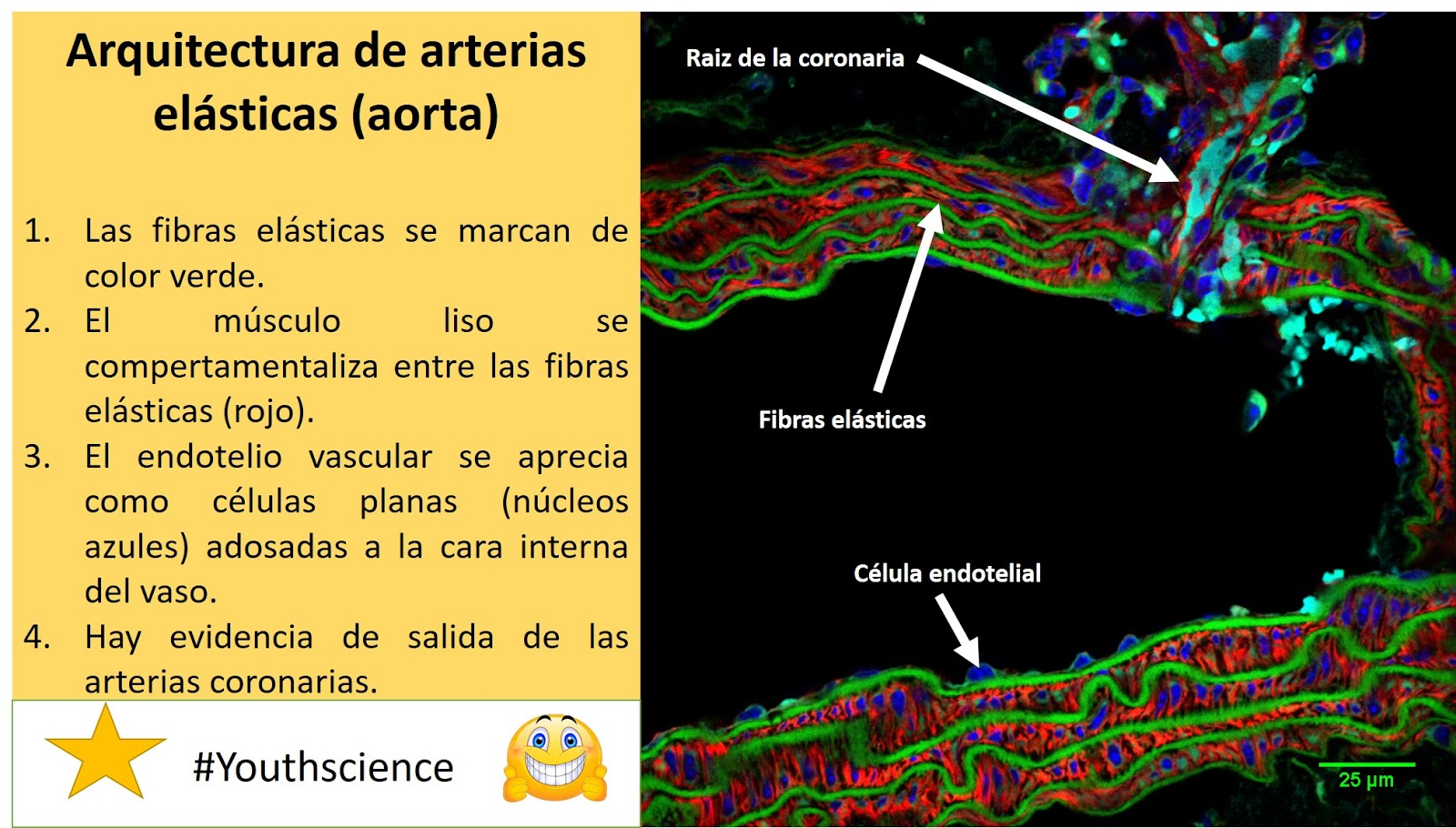 Anatomía microscópica de la arteria aorta