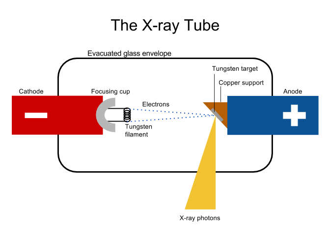 Radiographysics: The X-ray Tube