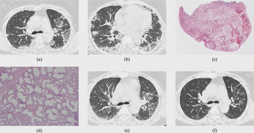 Ultimate Radiology : 'Semiology' - The Signs in Radiology