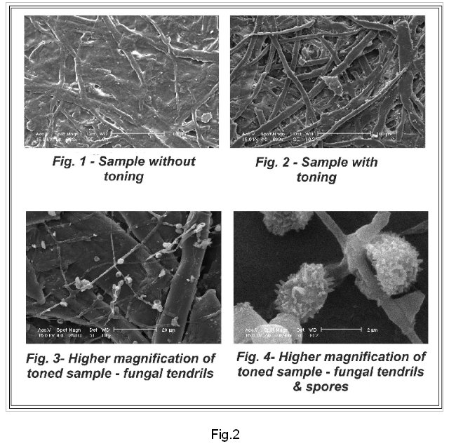 Perfs14: Foxing – is it a health hazard?