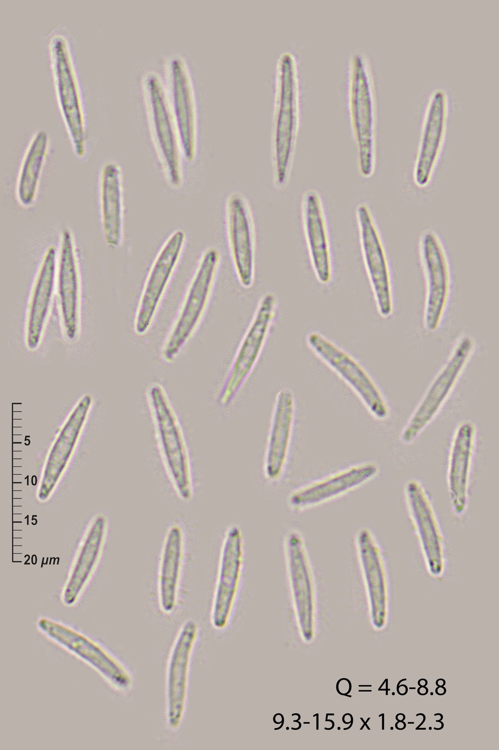 Lachnum longipilosum Svrček • CEMAS • Orden Helotiales