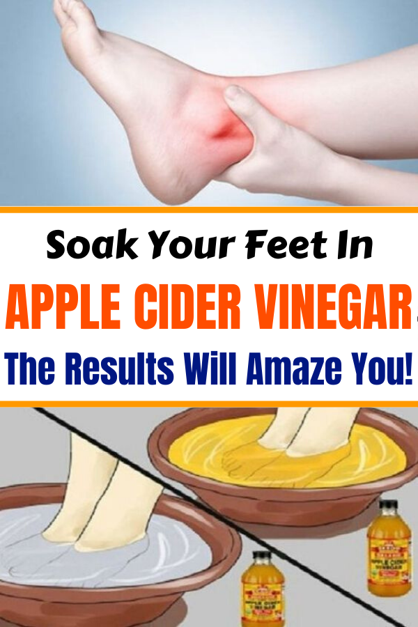 Soak Your Feet In Apple Cider Vinegar The Results Will Amaze You Only Tips