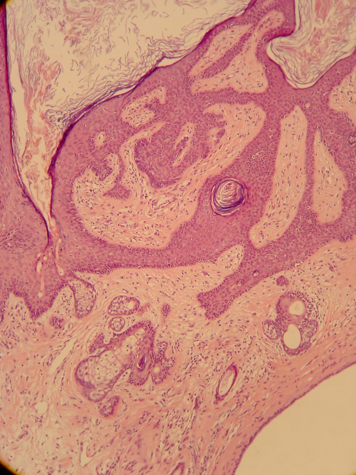 dermatopatologia para iniciantes: Março 2013