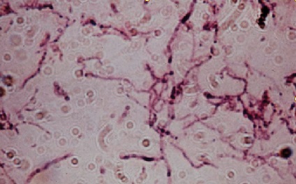 Lecture Notes in Medical Technology: Lecture #16: INTRODUCTION TO MYCOLOGY