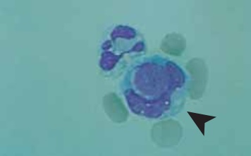 [Haematology] Atlas of Synovial Fluid | Free Medical Atlas
