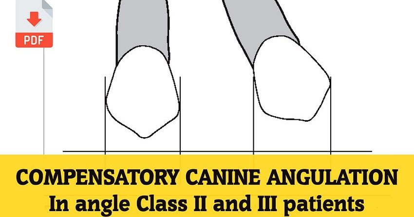 PDF: Compensatory canine angulation in angle Class II and III patients ...