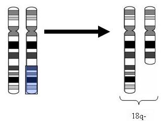 Alteraciones Geneticas