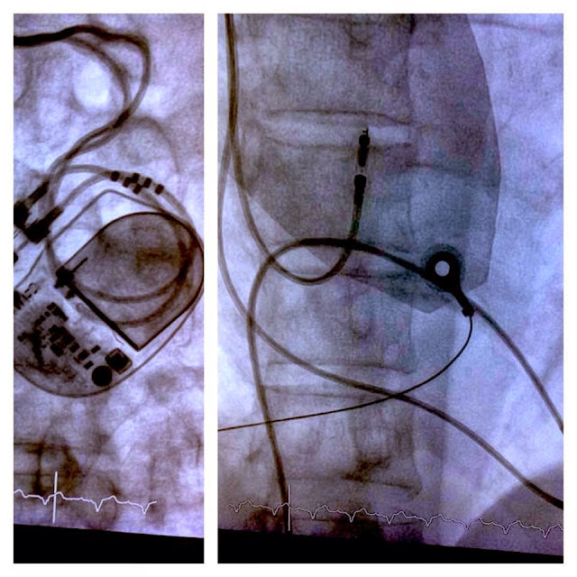 Dr.Nabil Paktin's Journal of Cardiovascular Medicine Blog ژورنال ( قلب ...